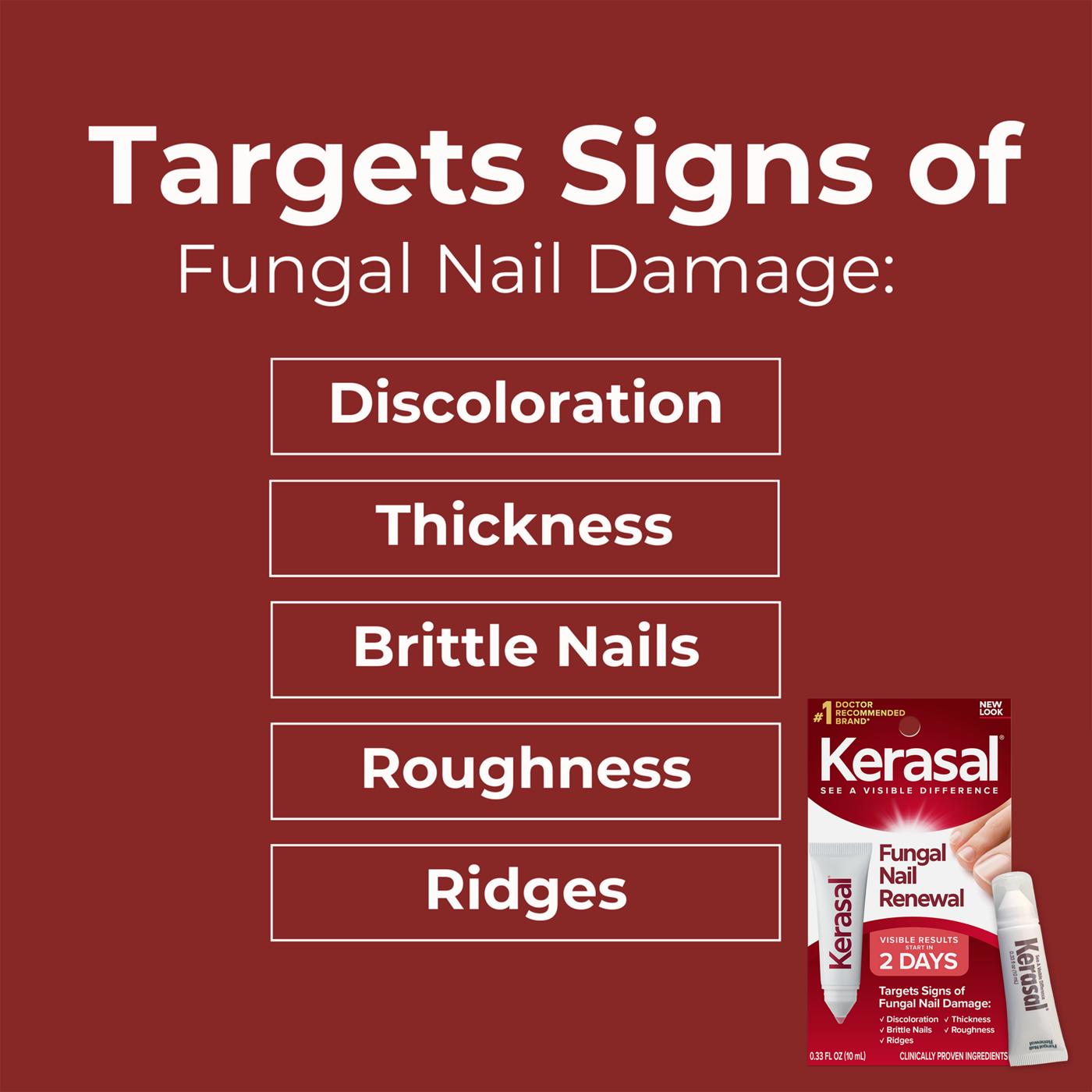 Kerasal Fungal Nail Renewal Solution - Shop Skin & scalp treatments at ...