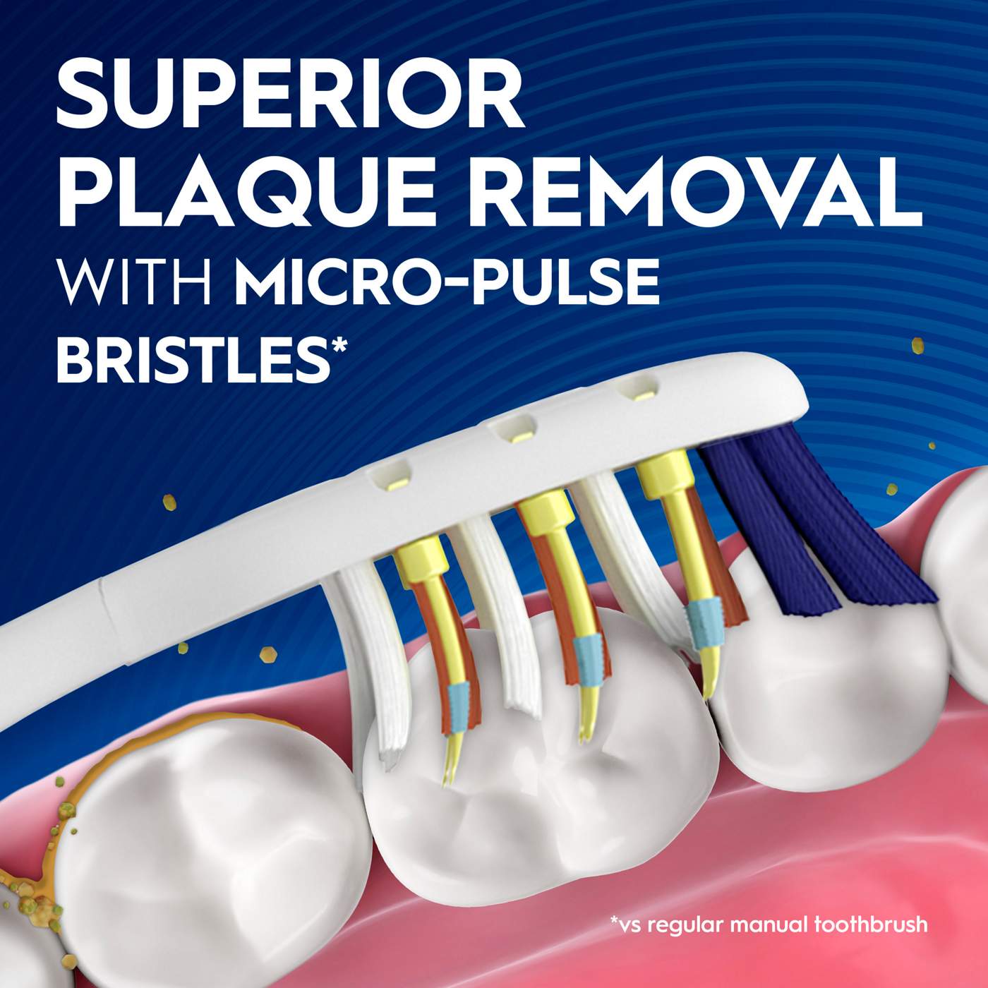 Oral-B Pulsar Expert Clean Battery Soft Toothbrushes - Shop ...