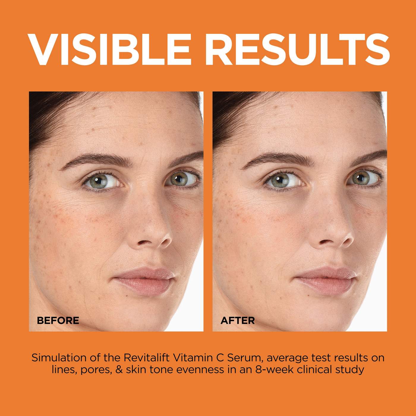 L'Oréal Paris Revitalift Derm Intensives 12% Vitamin C + E + Salicylic ...