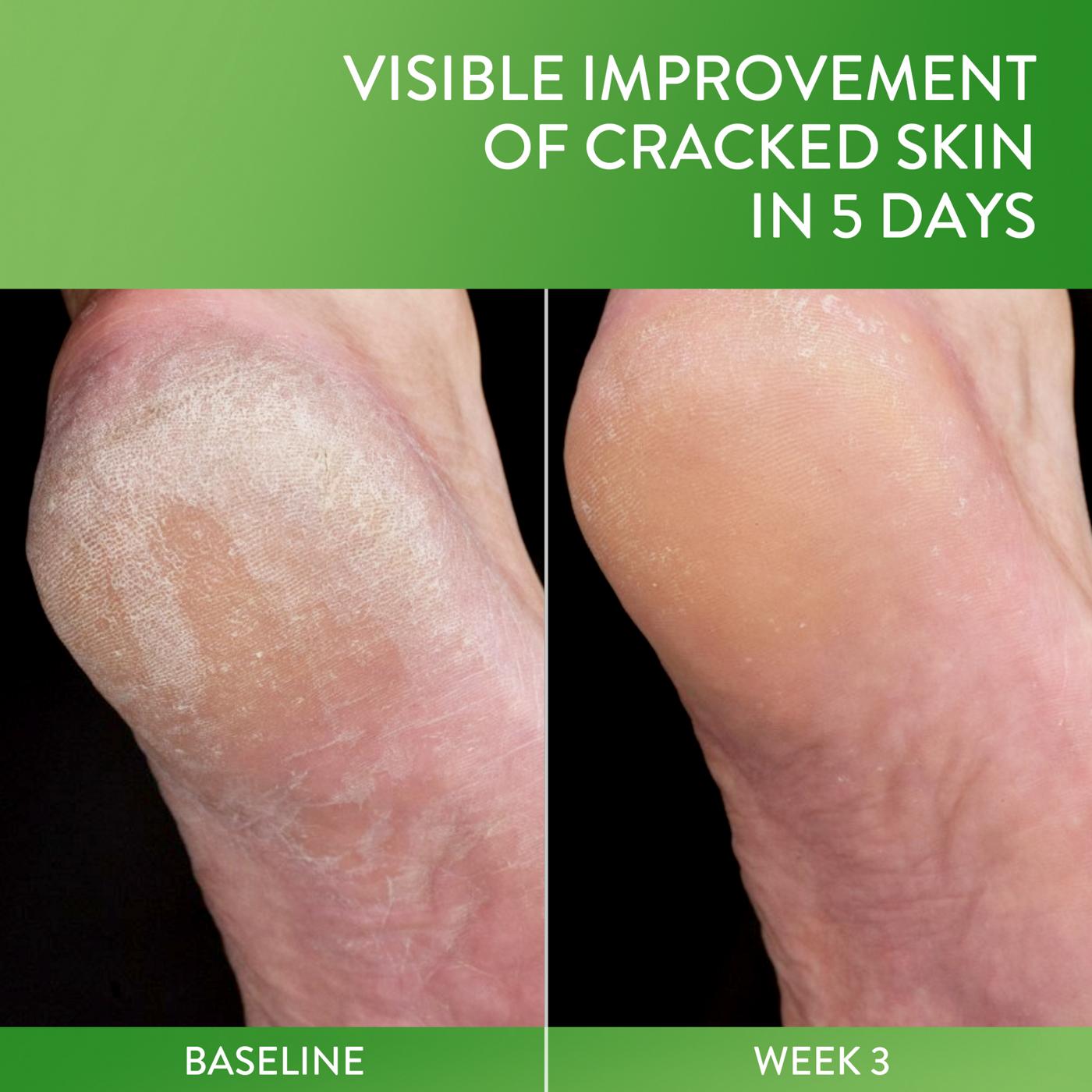 Cetaphil Cracked Skin Repair Balm - Shop Body lotion at H-E-B